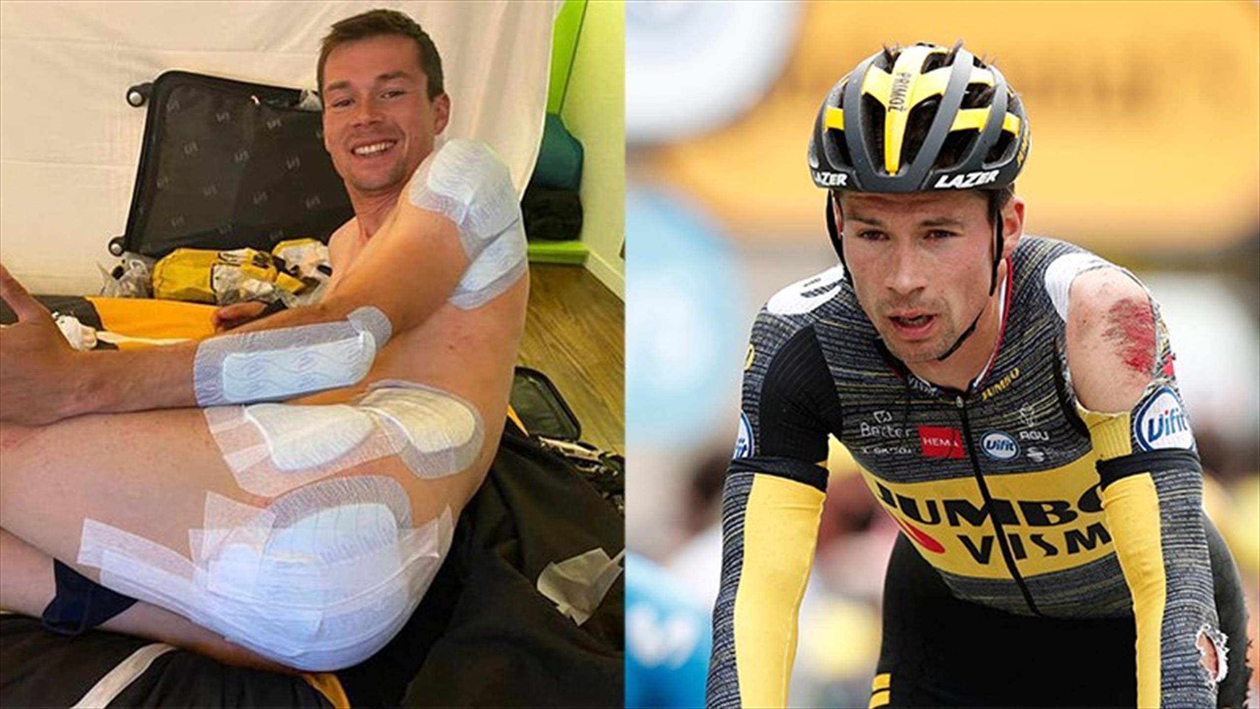 Tour de Francia 2021 | Así quedó Roglic tras su caída: impactante ...